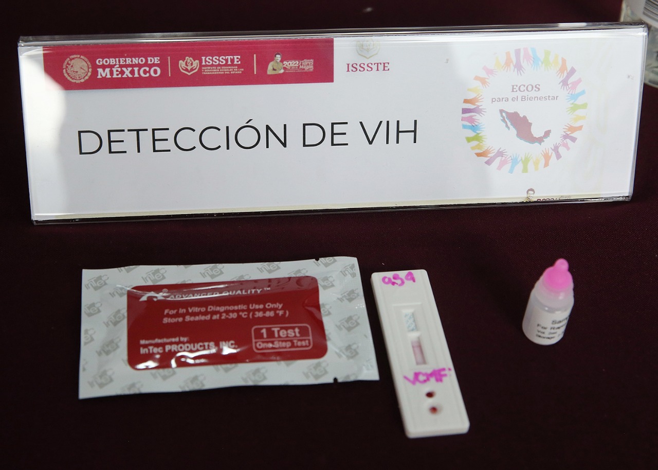 Issste facilita acceso a diagnóstico y tratamiento integral de VIH y ...